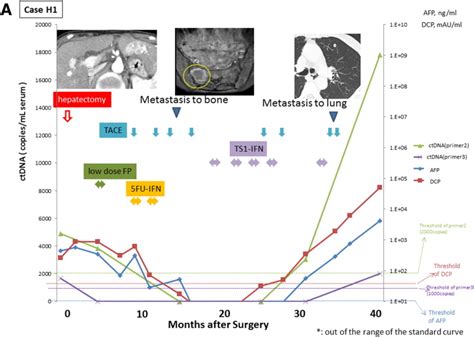 Monitoring Of Serial Circulating Tumor Dna Ctdna Levels The Ctdna
