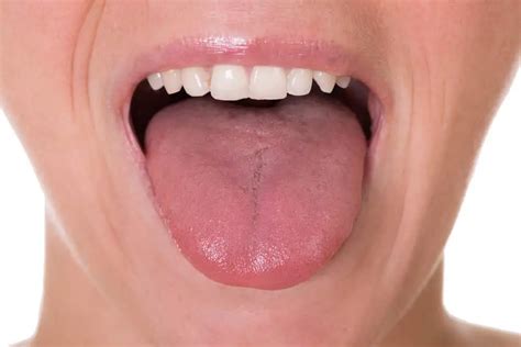 What Does A Healthy Tongue Look Like Pictures And Issues Acacia Ridge