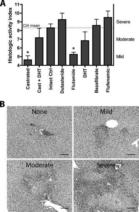 Sex Hormone Influence On Hepatitis In Young Male Ajcr Mice Infected