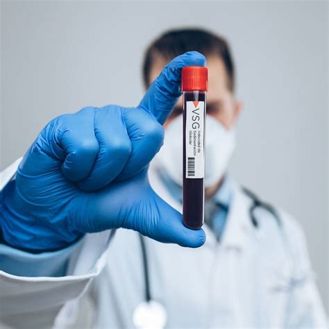 ¿sabes Qué Es La Velocidad De Sedimentación Globular Reumatólogo En Monterrey Dr Kiber