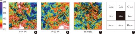 Overlap Of Complex Fractionated Electrogram Cycle Length Cfe Cl And Download Scientific