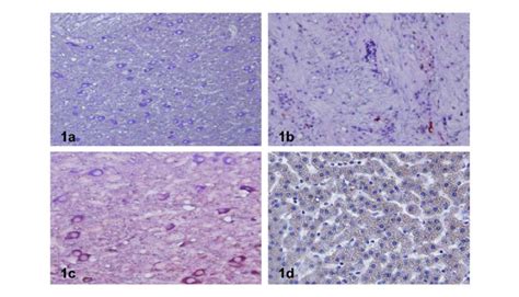 Immunohistochemical Detection Of Nse And Wnv Antigen In Brain Of