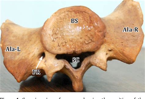 Posterior Sacrum Anatomy
