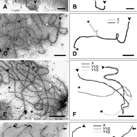 Electron Micrographs Of Pachytene Synaptonemal Complex Configurations Download Scientific