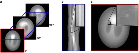 Principle Of Ring Artifact Correction With Modified Sinogram Processing Download Scientific