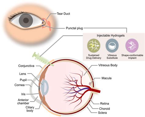 Ocular Applications Of Injectable Thermogels Download Scientific Diagram