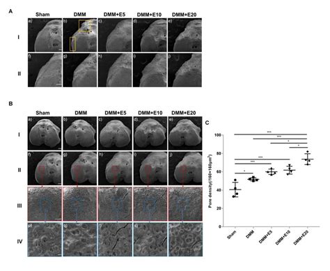 scanning electron microscopy sem analysis of subchondral bone a