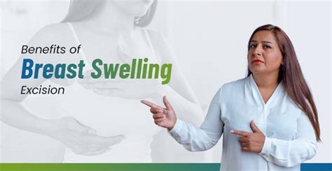 Breast Swelling Excision Causes Procedures And Benefits