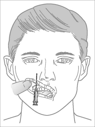 Regional Nerve Blocks Anesthesia Key