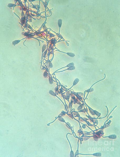 Spermatocytes Art Fine Art America