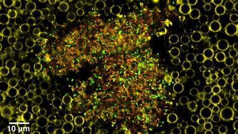 New Ultrasound Drug Delivery System Highly Effective Against Bacterial