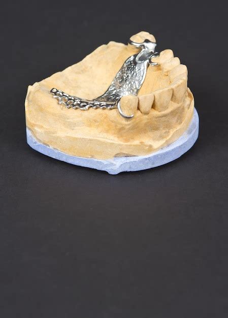 Premium Photo Metal Framework Of A Partial Prothesis Premium Photo Metal Framework Of A Partial Prothesis