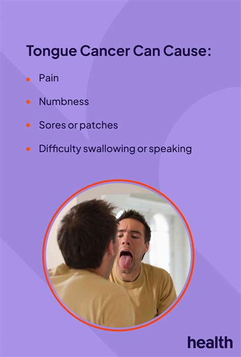 Base Of Tongue Cancer Symptoms