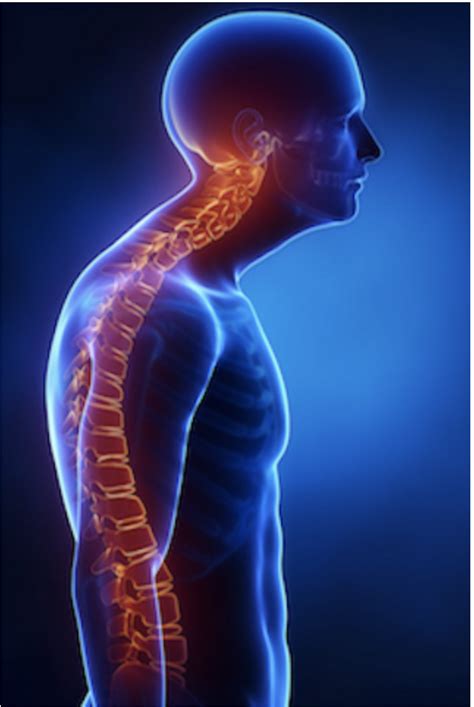 Dowagers Hump Back Care Clinic