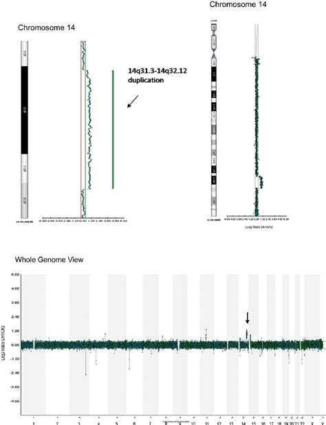 Oligonucleotide Based Array Comparative Genomic Hybridization On