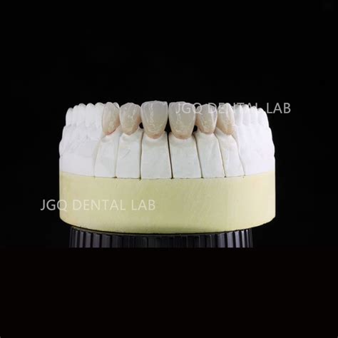 Perfect Looking Glazed Included Fixed Denture Zirconia Crowns And Bridges