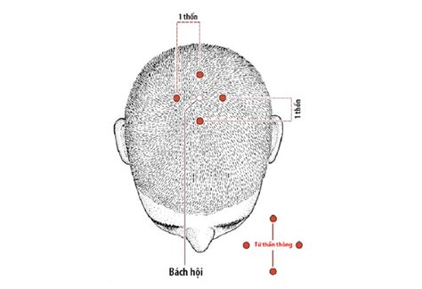 Huyệt Tứ Thần Thông Là Gì Khả Năng Chữa Bệnh Của Huyệt