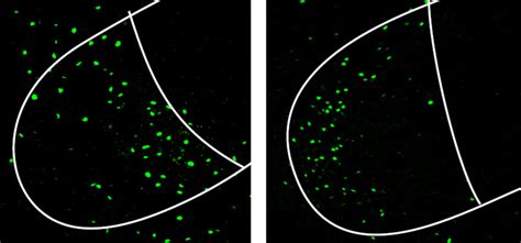 Brain Aggression And Sex Centre Wired Differently In Males And Females Technology Networks
