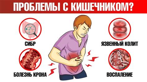 Самый простой способ определить есть ли проблемы с ЖКТ🙌 Youtube