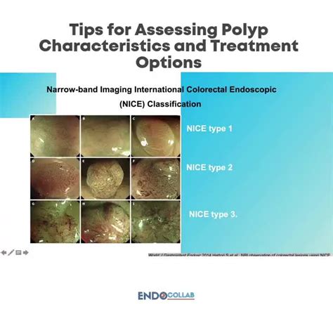 Klaus Mönkemüller On Linkedin Your Quick Checklist For Mastering The Nice Classification System