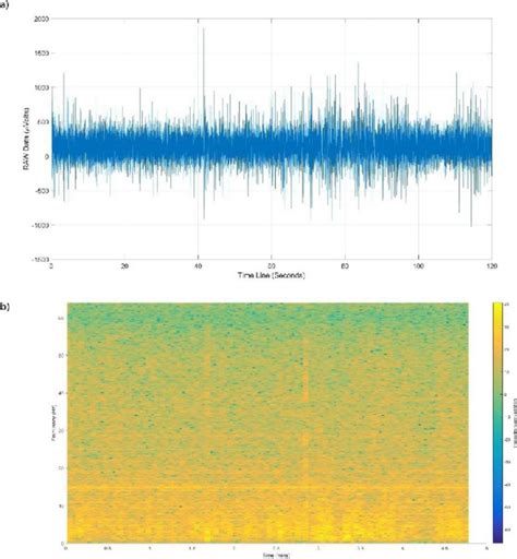 Power Spectral Analysis Of Bioacoustic Signals Emitted By A Bottlenose