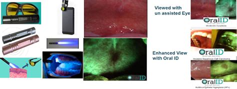 Oral Tissue Examination Device