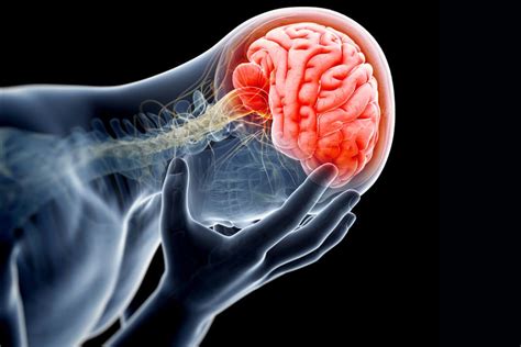 50 Facts About Intracerebral Hemorrhage