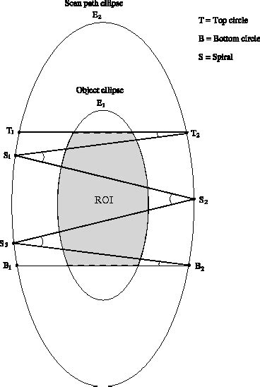 Figure 1 From A Sufficient Condition For Spiral Cone Beam Long Object Imaging Via Backprojection