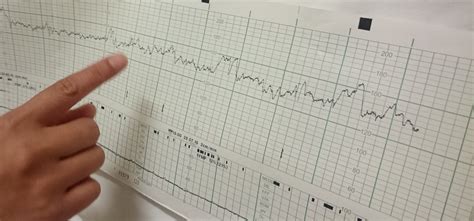 The Case For Telemetry In WordPress MOR