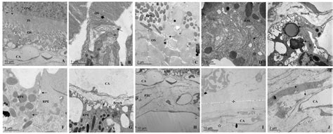Tem Observations Of Transplanted Rpe Partial Thickness Choroidal Sheets Download Scientific