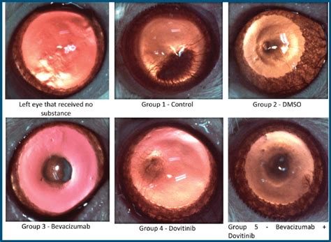 Percentages Of Corneal Neovascularization Were Assessed By Examining Download Scientific