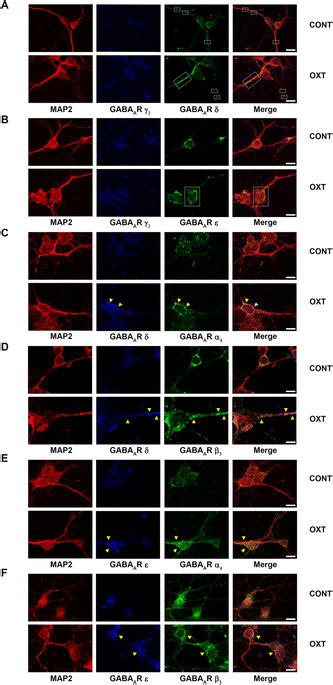 Localization Of δ γ2 α4 β3 And ε Gabaar Subunits Expression On