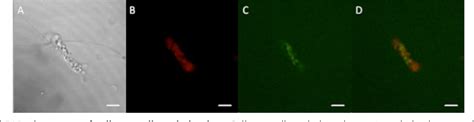 Figure 3 From Prothrombin Activation By Platelet Associated Prothrombinase Proceeds Through The