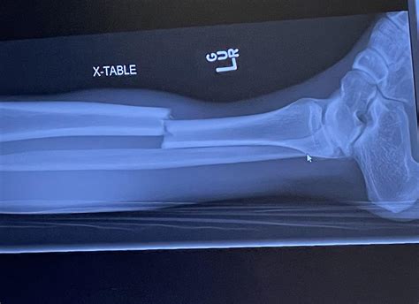 2331 Best R Rollerblading Images On Pholder Just Got Part Of My Halloween Costume Done Jet