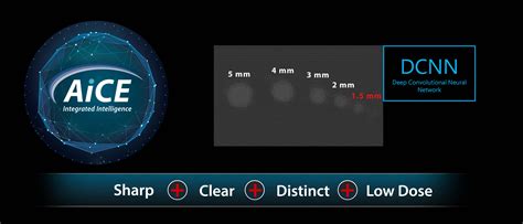 Aice Dcnn