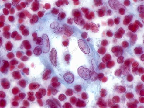 Lymph Node Human LM Stock Image C Science Photo Library