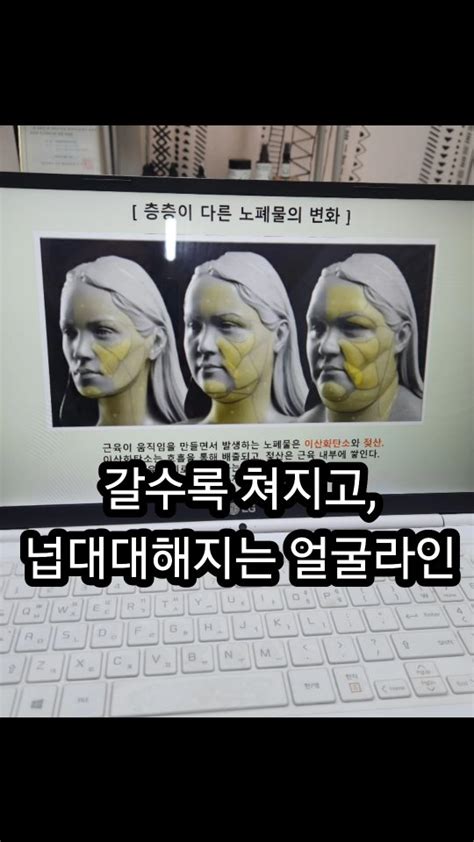 김해 에스테틱수연 목 윤곽전문 순환테라피 한숨 푹~ 자면서 예뻐지는 법 ‼️ 얼굴과 머리의 모든 노폐물이 빠지는 유일한 길 목 목의 순환이 약해