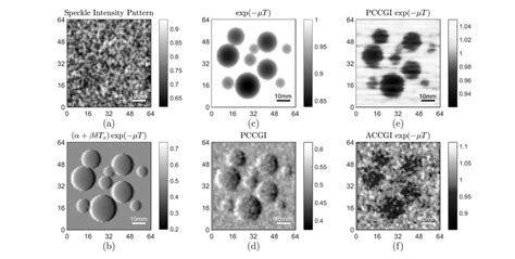 Comparison Of X Ray Phase Contrast And Absorption Contrast