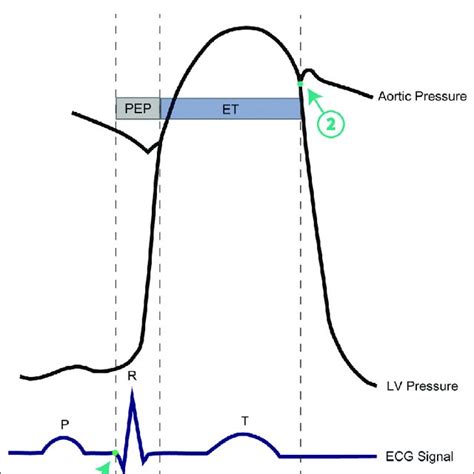 Representation Of The Aortic Pressure Waveform The Left Ventricular Download Scientific