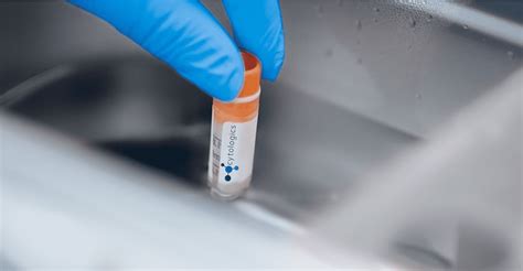 Pbmc Thawing Protocol How To Optimize Cell Recovery