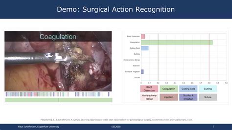 Detecting Semantics In Endoscopic Videos With Deep Neural Networks Ppt