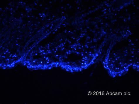 封固剂with Dapi Aqueous，fluoroshield Abcam中文官网