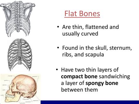 Ppt Classification Of Bones Powerpoint Presentation Free Download Id3998329