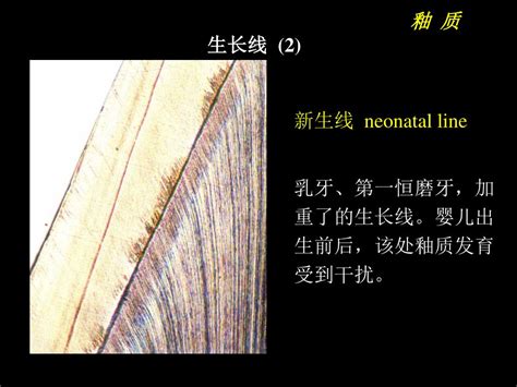 Ppt 口腔组织病理学 Oral Histology And Pathology Powerpoint Presentation Id