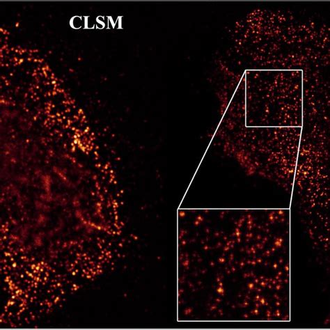 Multiphoton Fluorescence Microscopy Sections At Different Time Points