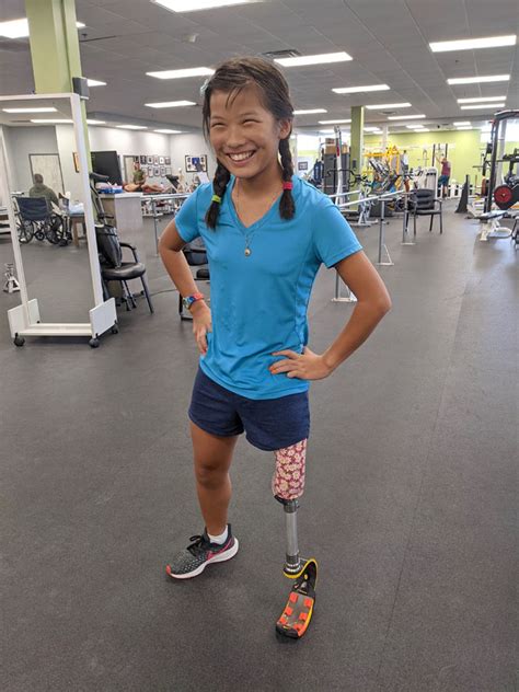 Pffd Prosthetic And Orthotic Associates