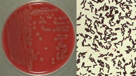 Contamination Preservation And Spoilage Of Cereals And Cereal