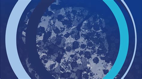 Easd E Learning Provided By Leading Diabetes Academics