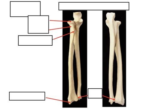 Appendicular Skeleton Upper Limb 5 Quiz