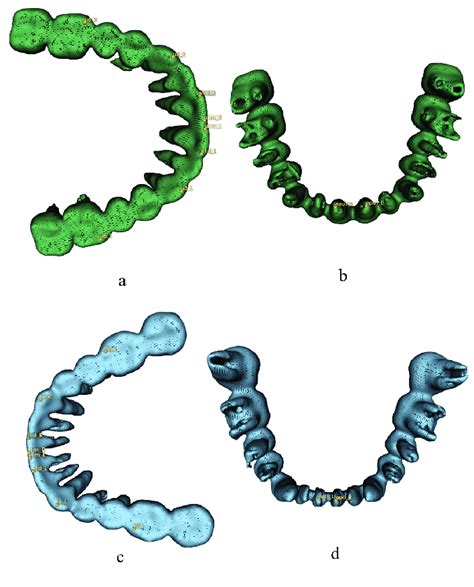 Mandibular Landmarks For 3d Analysis Definitions Are Provided In Table Download Scientific